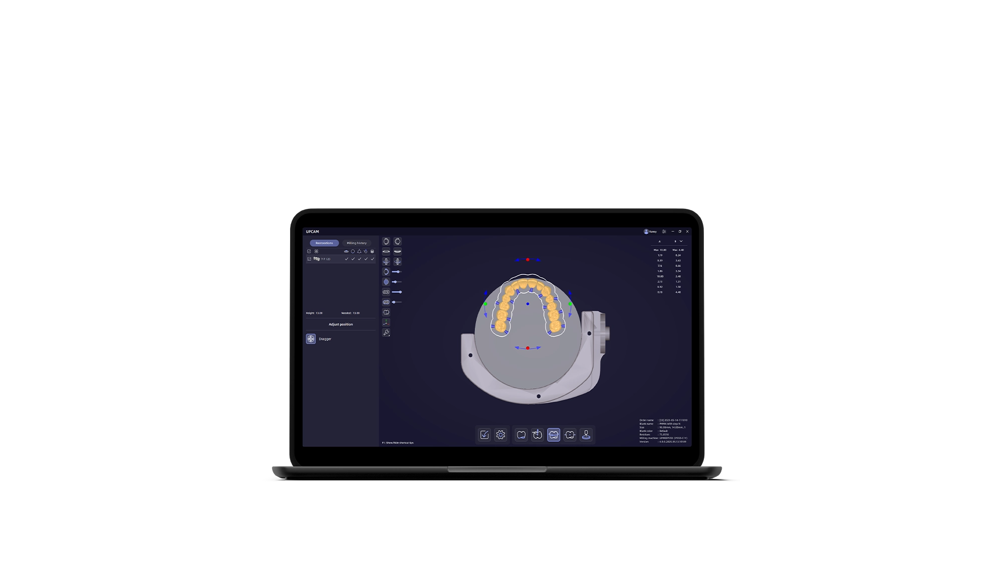 UP3D Lab Solution | Complete Dental CAD/CAM Workflow for Every Lab