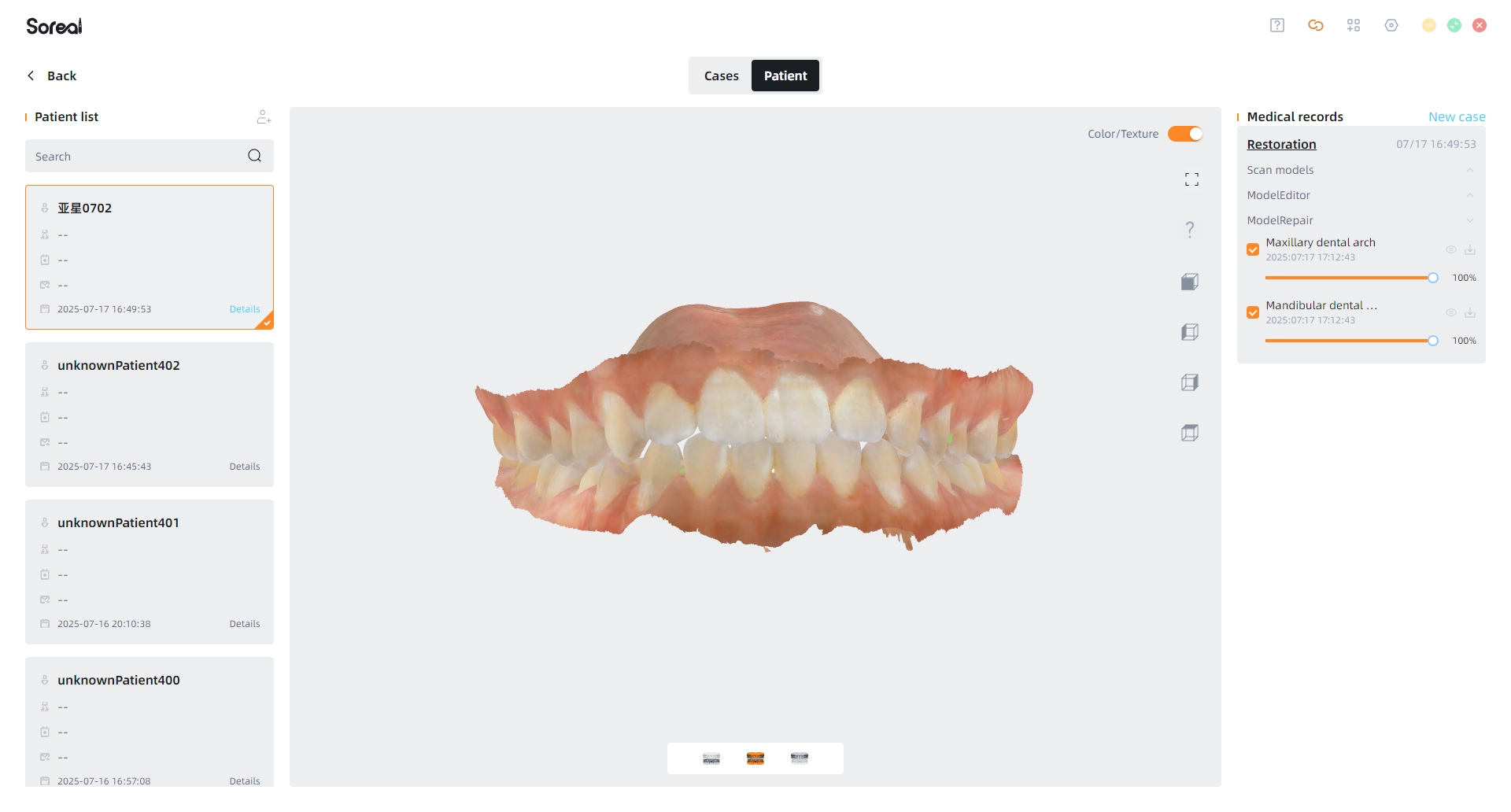 UP610 Intraoral Scanner | High-Precision, Lightweight & Fast Scanning ...